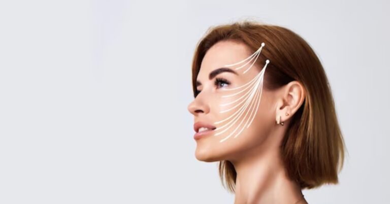 What Happens During A PDO Thread Lift? Step-by-Step Guide - Garden ...